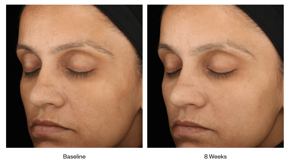 SkinMedica LUMIVIVE System: Clear Alleviating Skin Damage